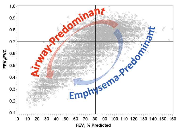 Epidemiology – COPD Gene Study